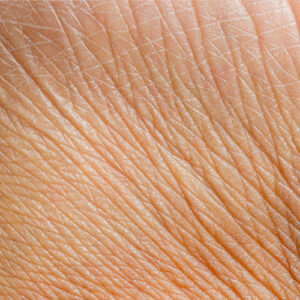 Wrinkles, Lines & Folds - SKIN Clinics