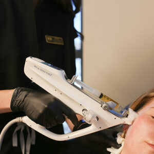 PRP for Facial and Hair Treatment - SKIN Clinics