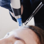 Metvix Photodynamic Therapy - SKIN Clinics