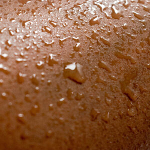 BOTOX for Hyperhidrosis (Excessive Sweating) - SKIN Clinics